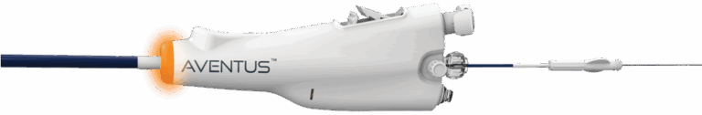 Inquis Medical | AVENTUS Precision Thrombectomy System